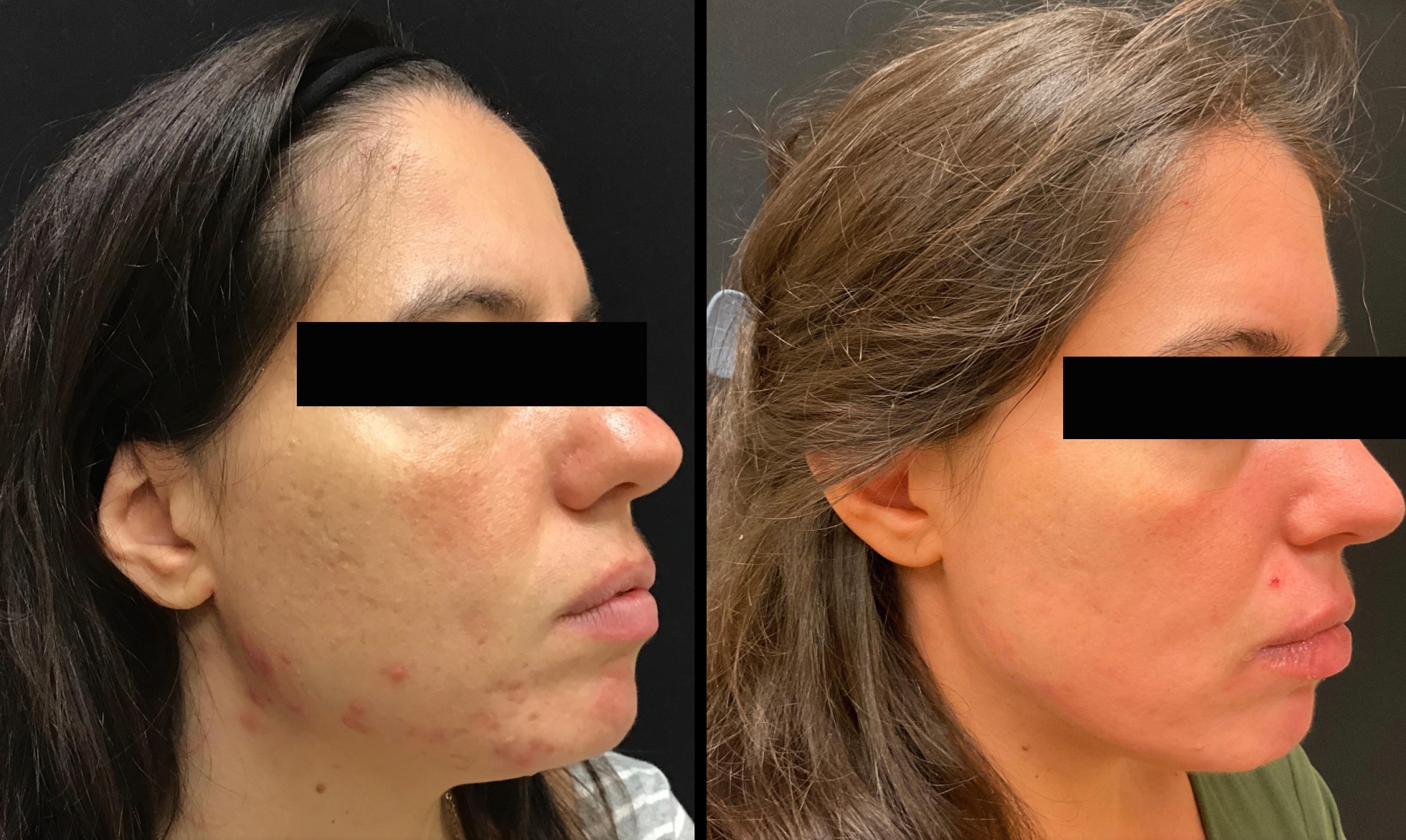 Why Is Retinol Important for Your Skincare Routine? | Dr. Ariel Ostad, MD