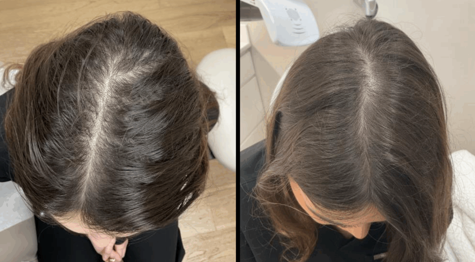 The Rise of Regenerative Beauty with Exosomes and What You Need to Know ...
